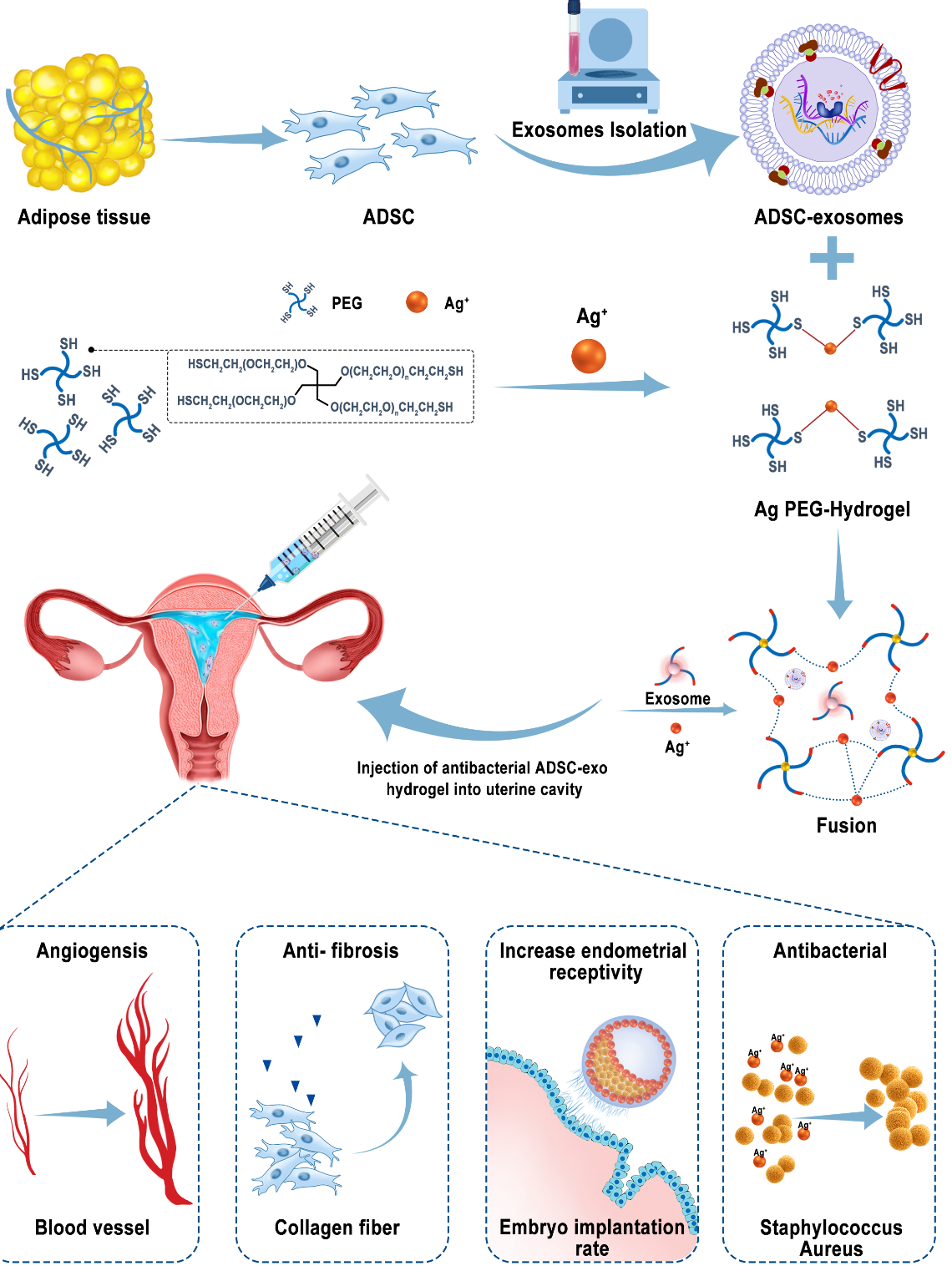 Zhen Wang et al. developed an injectable exosome-hydrogel system for ...